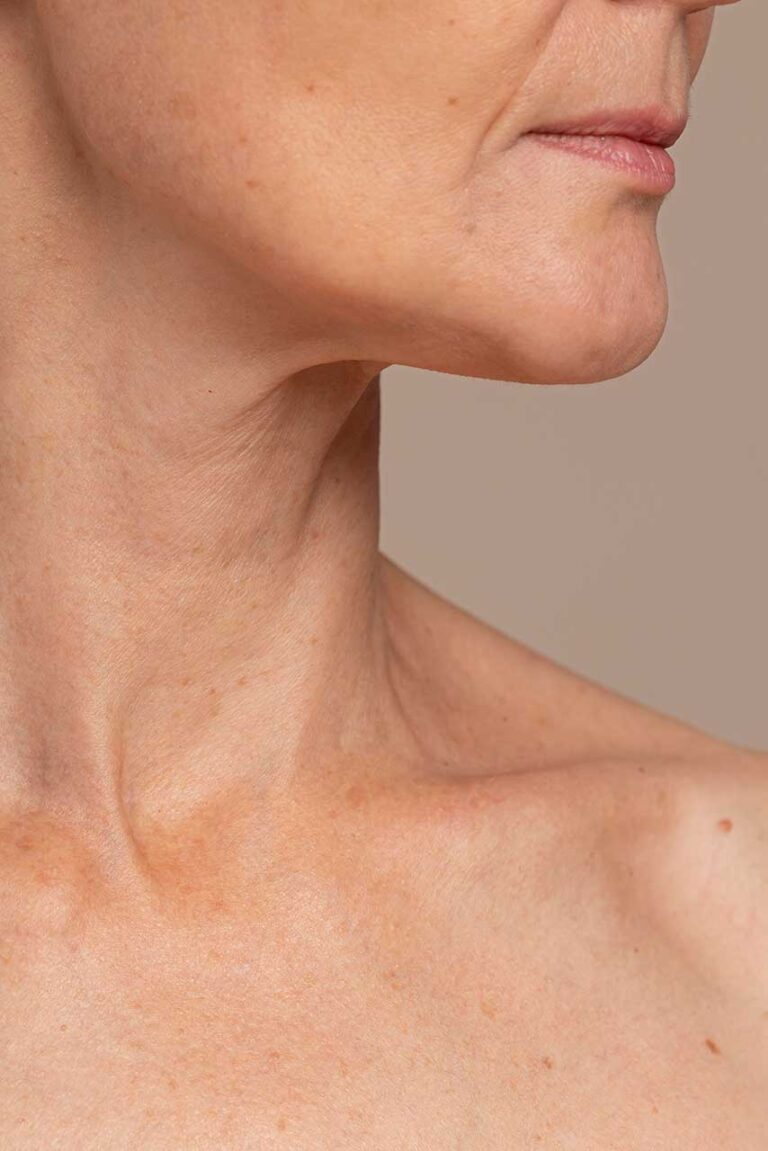 NECK THREADS - Go Fillers Tijuana