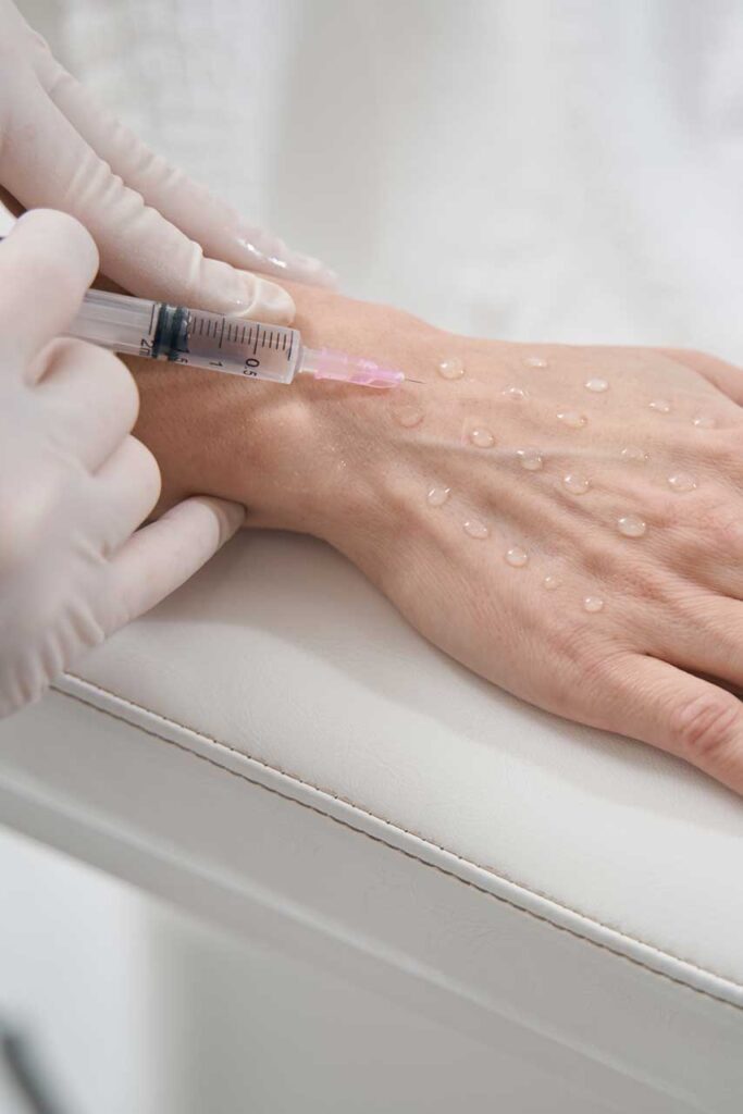 HAND REJUVENATION - Go Fillers Tijuana