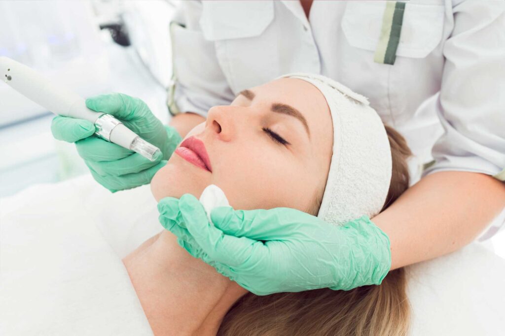 MICRONEEDLING - Go Fillers Tijuana