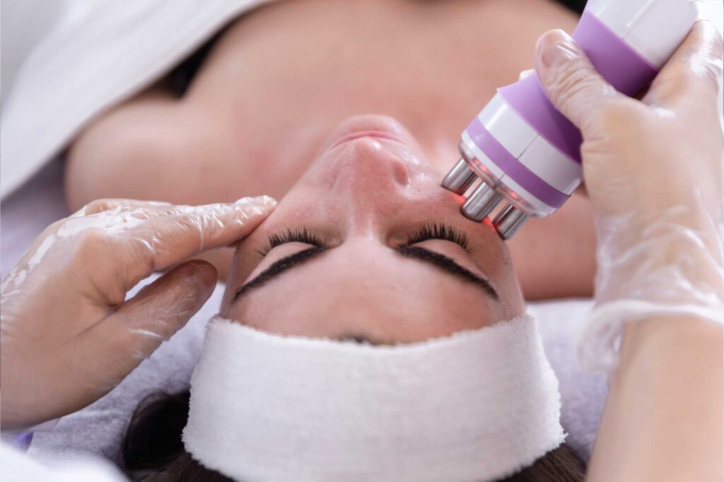 RADIOFREQUENCY - Go Fillers Tijuana